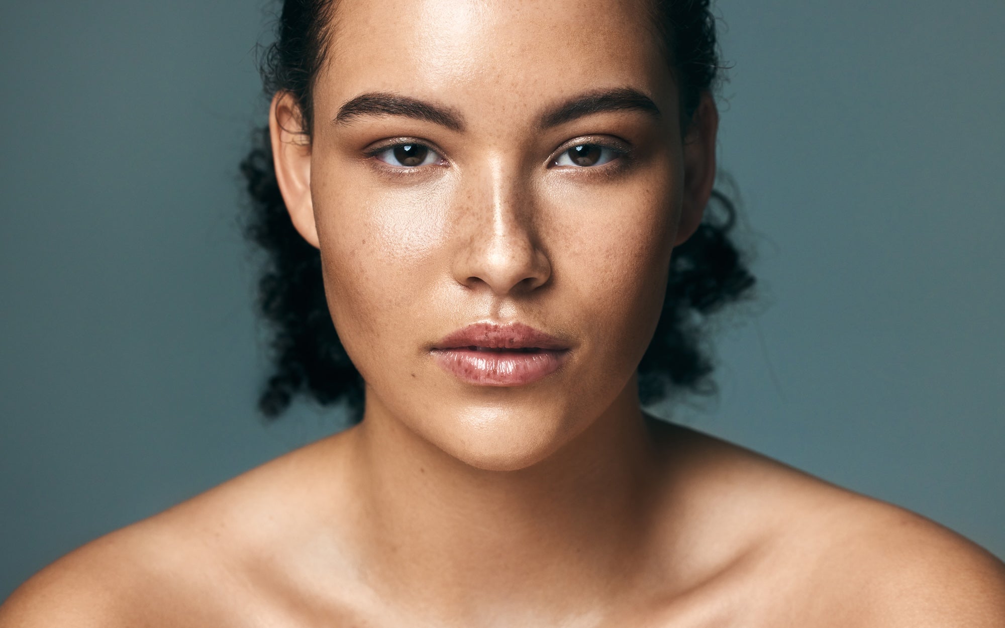 Post-Inflammatory Skin Changes: Treating Dark and Light Spots After Ac ...