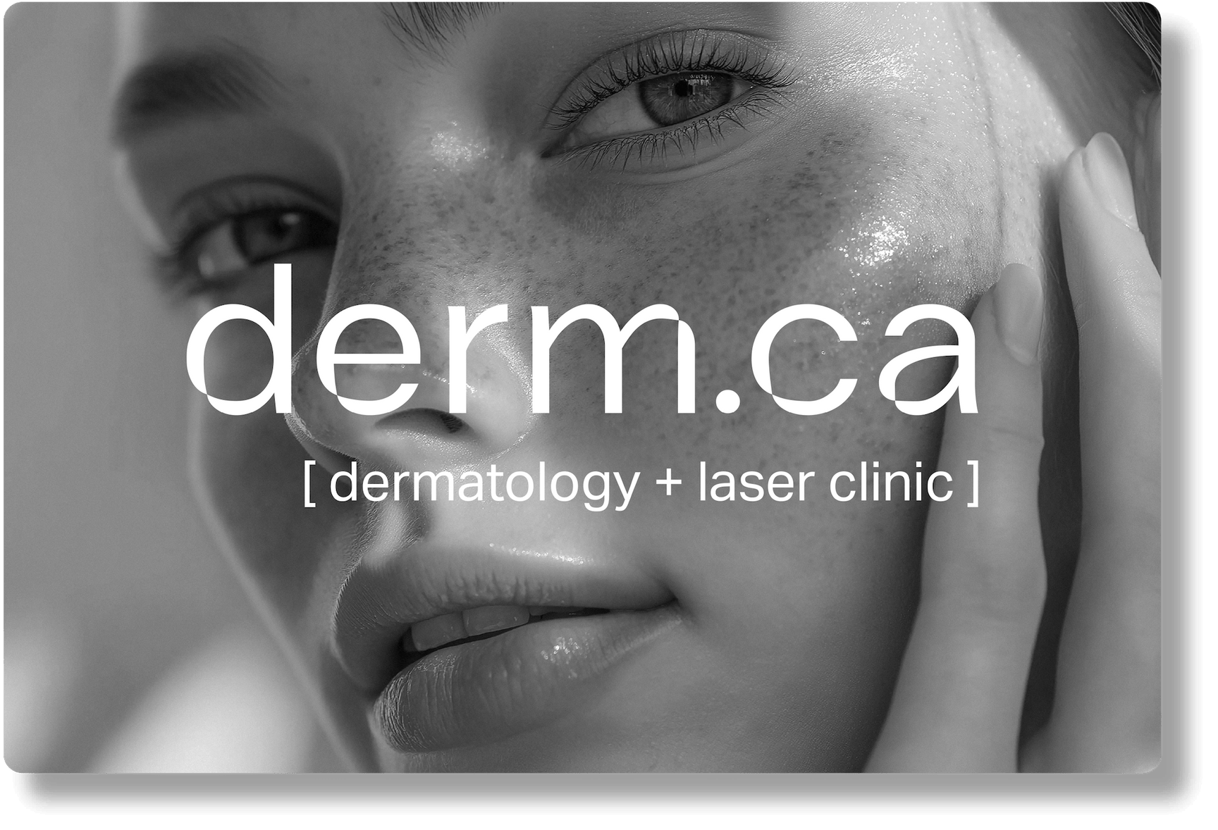 Mole Mapping Derm Ca